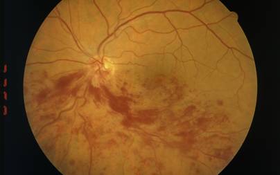 INTERNATIONAL SPECIALIST EYE CENTRE MALAYSIA